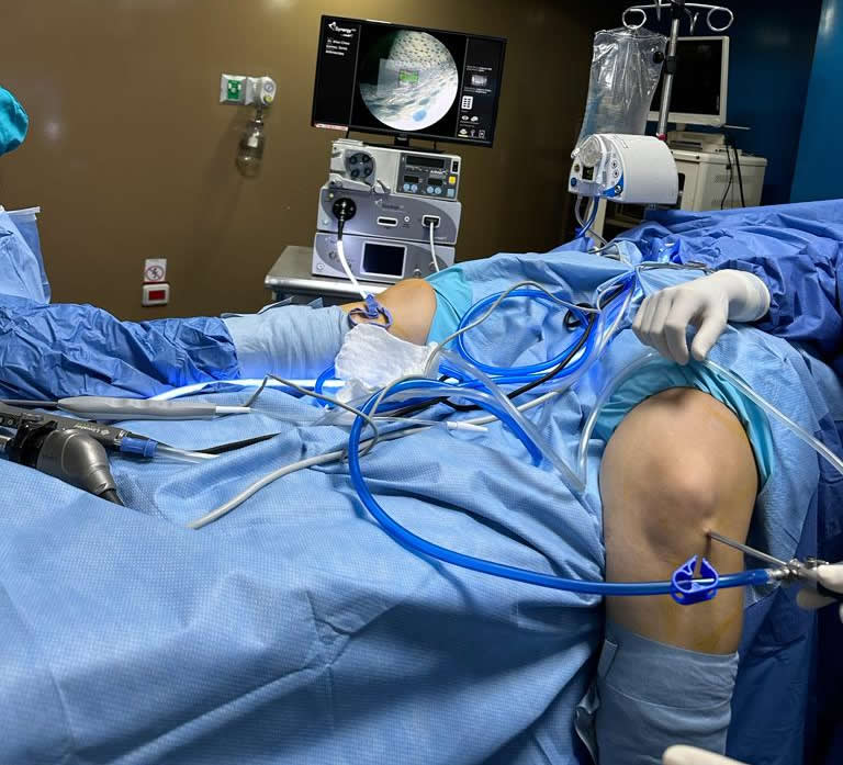 Clinica de Rodilla - Clinica de Artroscopia, ortopedia y traumatología ...